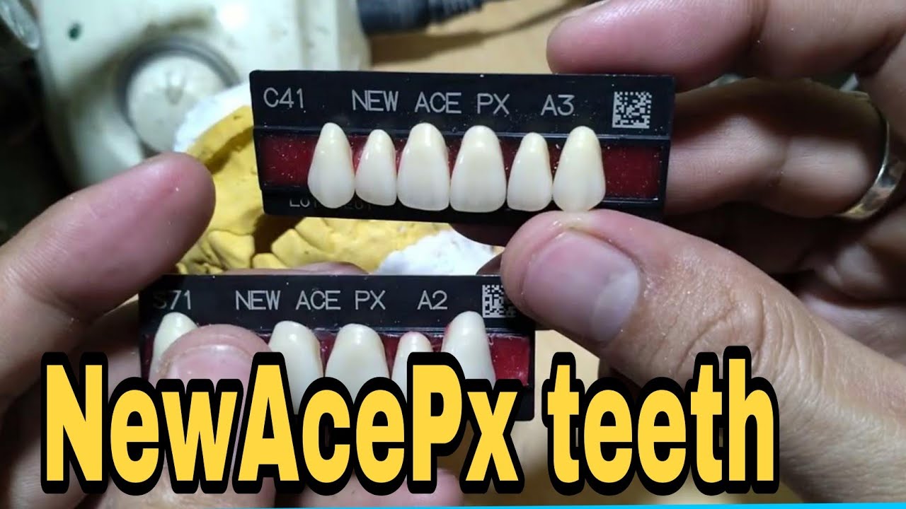Non Stainable Teeth sa Pustiso Natural Look NewAcePx Composite resin ...