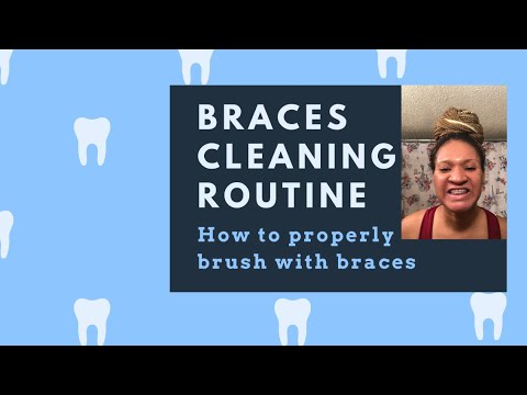 Cleaning Braces Routine| How to properly clean your braces - YouTube