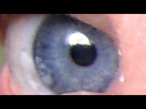 The Eye Challenge - YouTube
