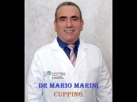 Dr Mario Marini. Medicina China. Americateve feb '19 - YouTube