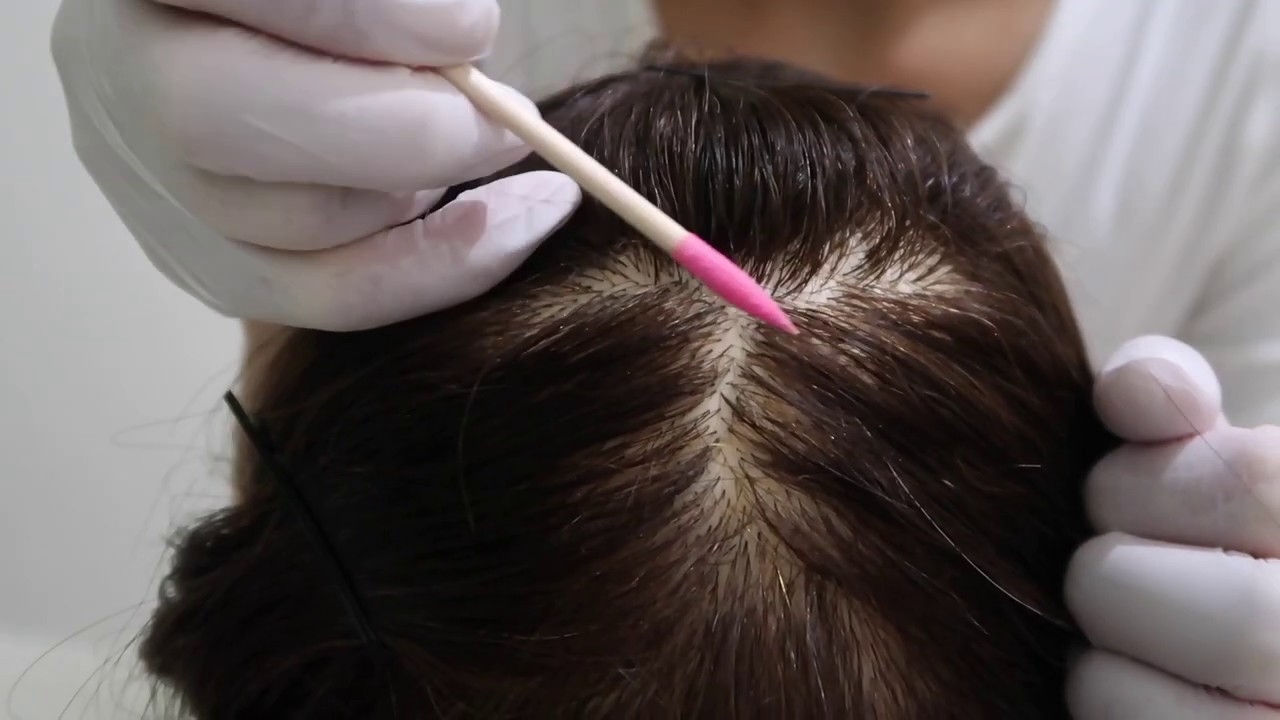 ASMR |Hypnosis Scalp Scratching Sounds |Helping You Fall Asleep |Stress ...