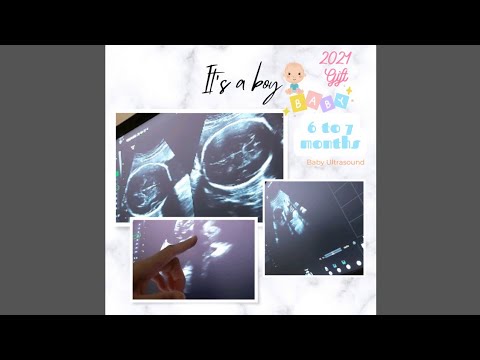 Baby ultrasound experience|24 & 27 weeks pregnant ultrasound|my baby ...