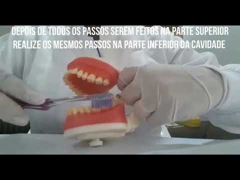 Técnica de Stillman modificada - YouTube