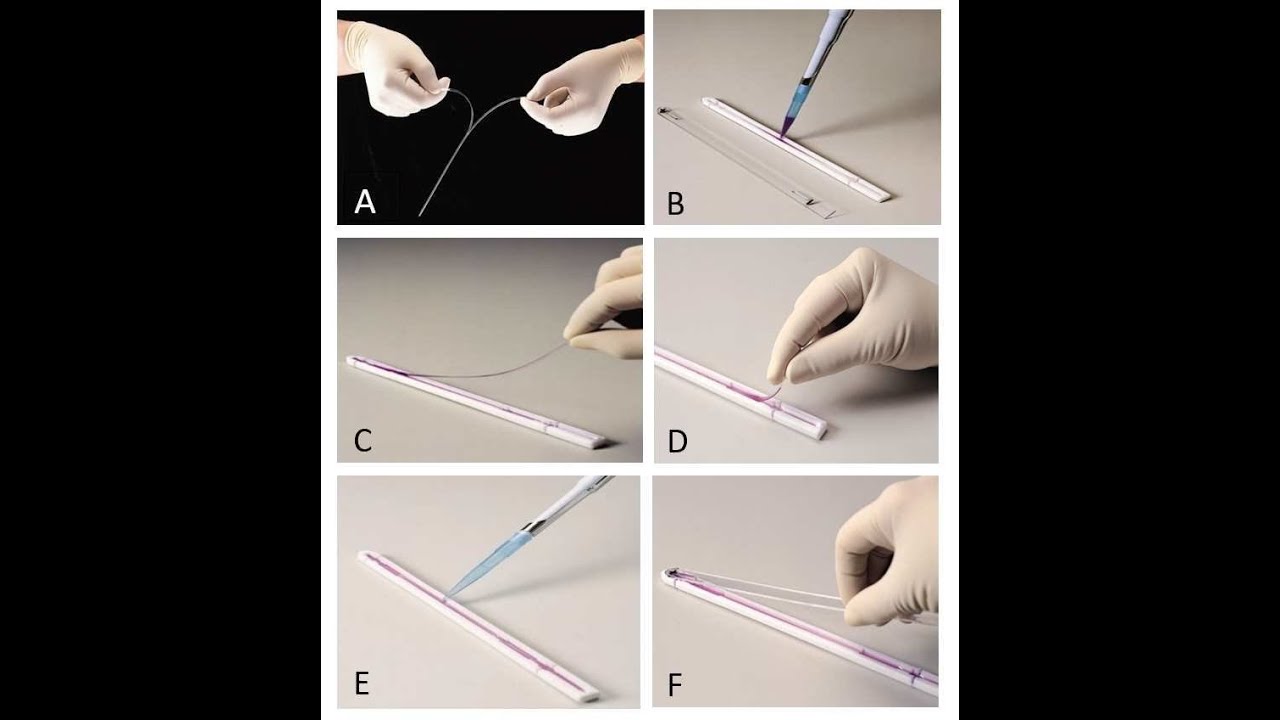 Two dimensional gel electrophoresis Part 1; Isoelectric Focusing (IEF ...