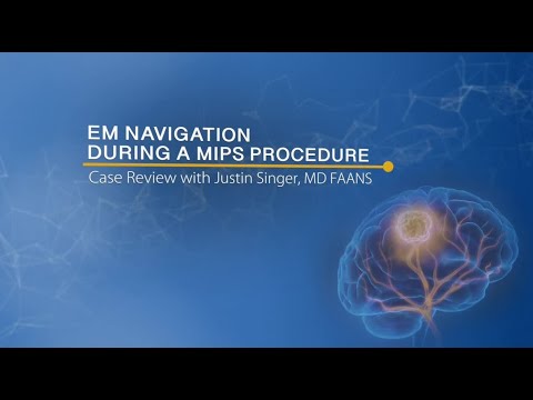 NICO BrainPath Navigation Probe Adapter, Justin Singer MD - YouTube