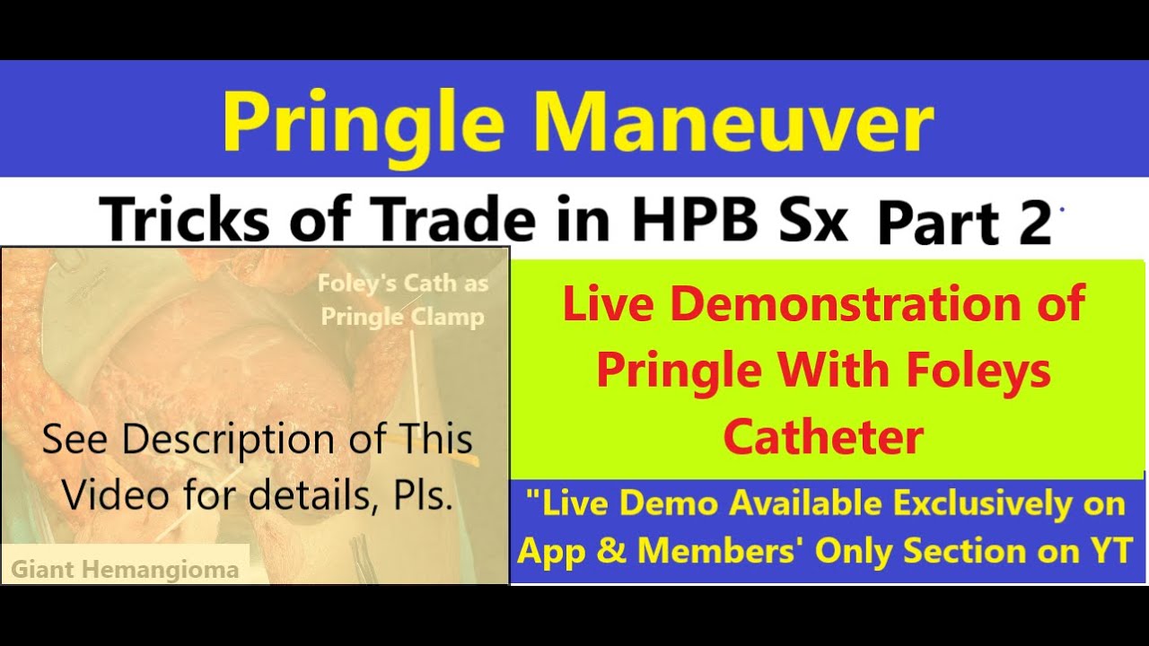 Pringle Maneuver - Live Demo. (Tricks of Trade HPBSx - 2/8). (See ...
