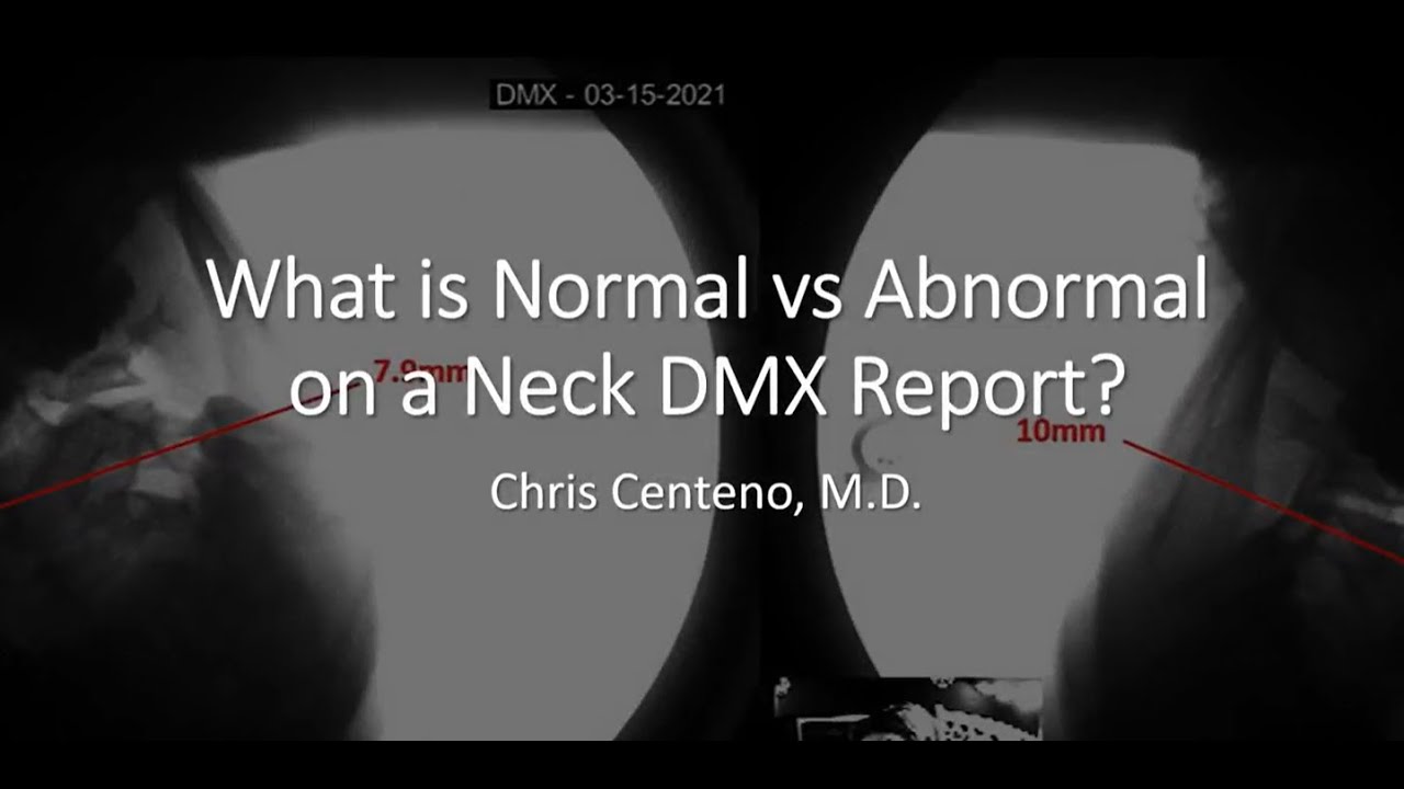 What is Normal and Abnormal on a Neck DMX? - YouTube