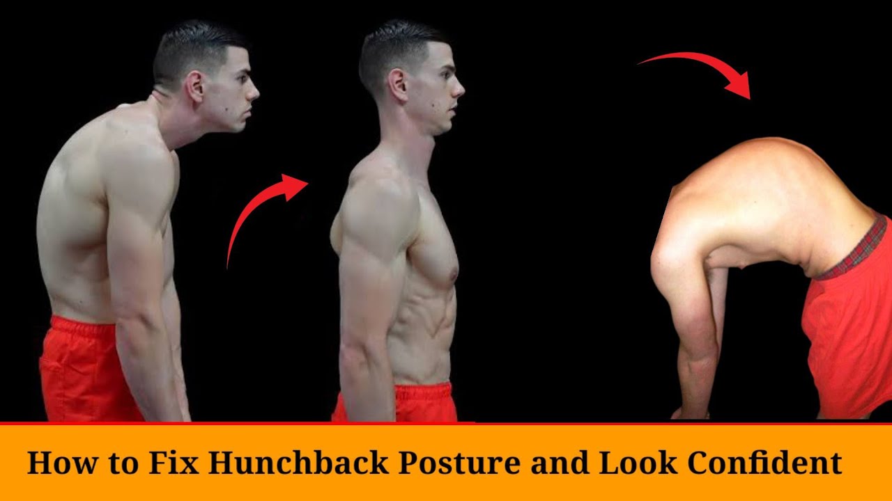 Fix Your Hunchback Posture in Just a Few Minutes a Day | Hunchback ...