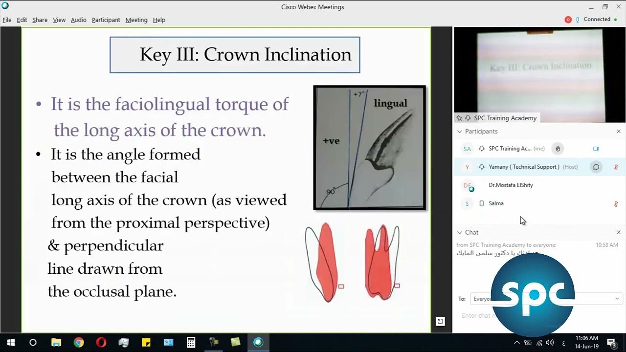 Crown Inclination - Orthodontic Program - SPC Training Academy - YouTube
