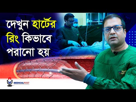 হার্টের রিং কিভাবে পরানো হয় সরাসরি ভিডিও | Heart Ring Live Surgery | Medical Post