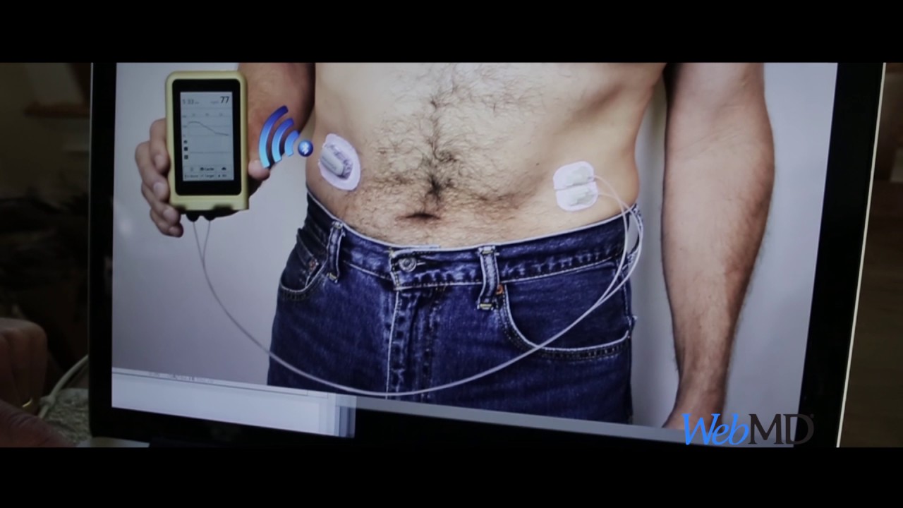 Ed Damiano: WebMD's 2016 Health Hero, Scientist - YouTube