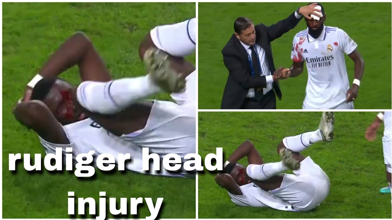 Rudiger Goal With Blood VS Shaktar Donetsk - YouTube