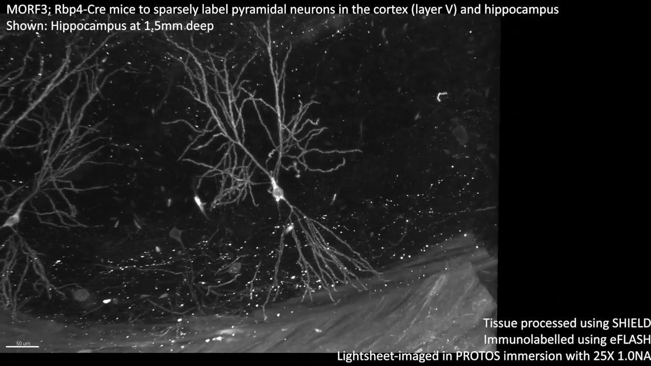 High-Resolution MORF3-labeled Hippocampal Neurons - YouTube