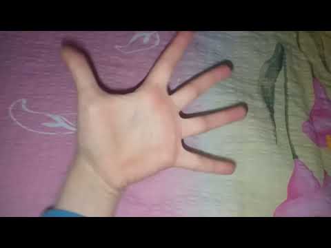 Üzücü video😔😩😖😭Erva tv