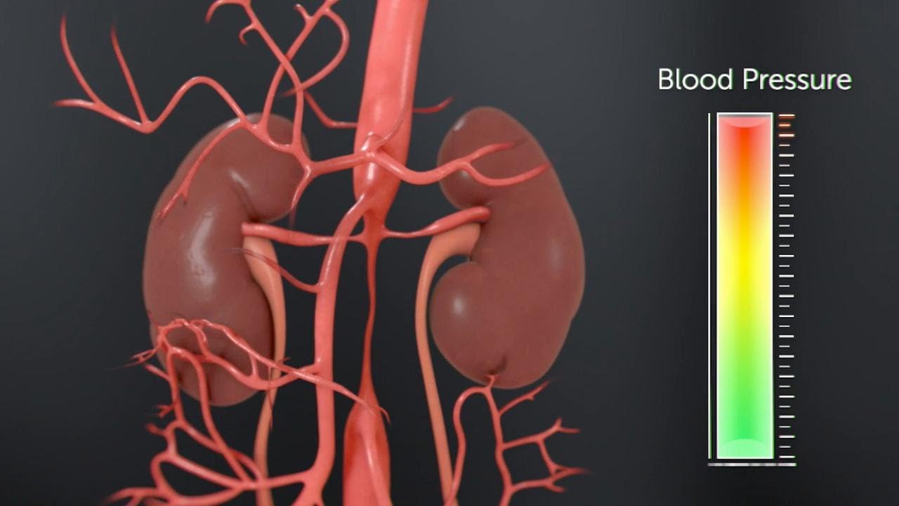 What is Midaortic Syndrome | Boston Children's Hospital - YouTube