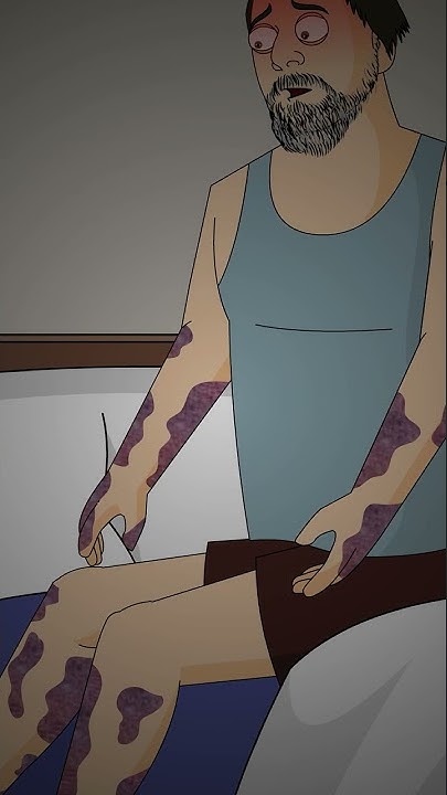 HE LOST ALL HIS LIMBS😳 - YouTube