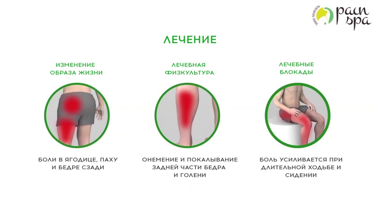 Piriformis Injection - YouTube