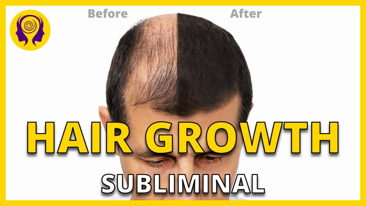 ★HAIR GROWTH★ Cure Baldness & Regrow Thick Full Hair! - SUBLIMINAL ...