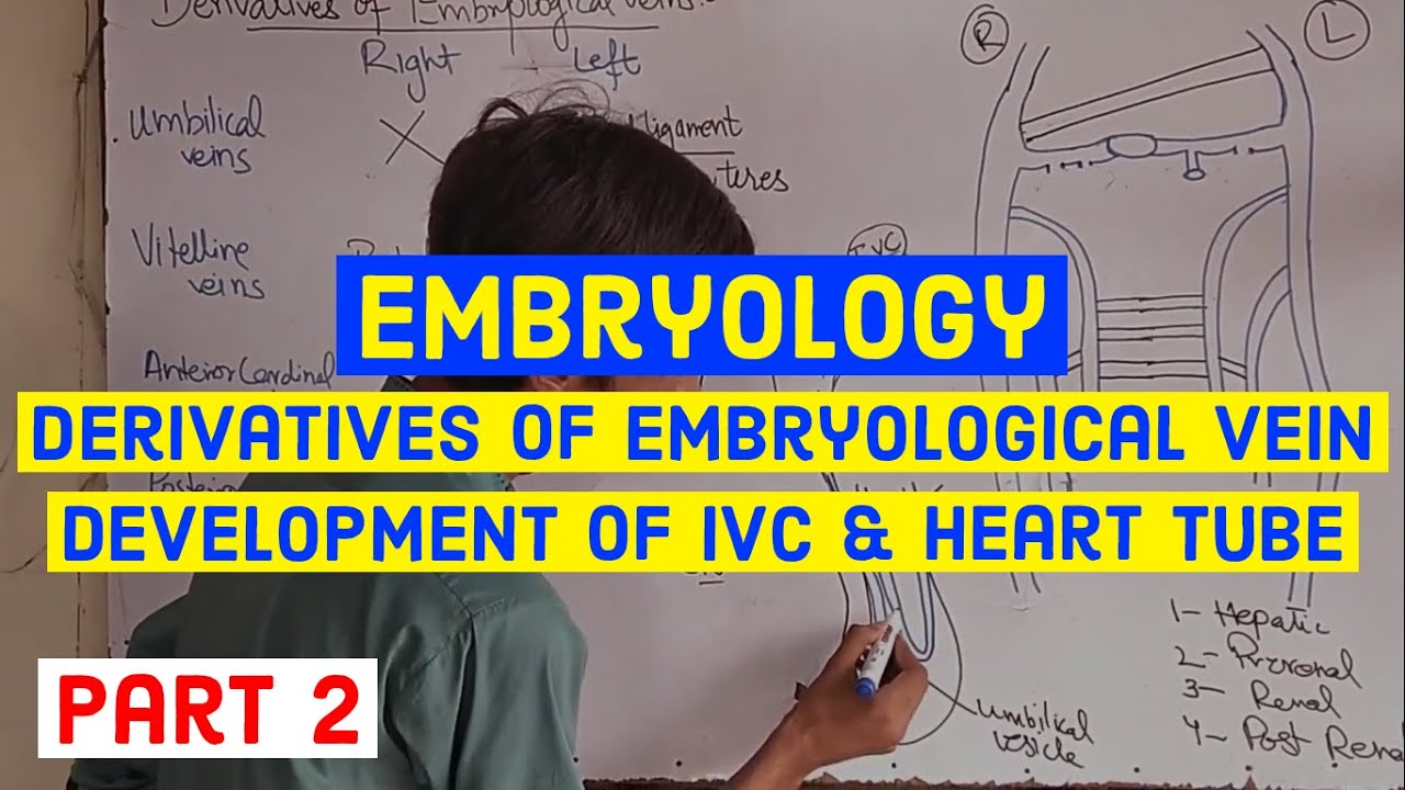 DERIVATIVES OF EMBRYOLOGICAL VEIN, DEVELOPMENT OF IVC & HEART TUBE ...