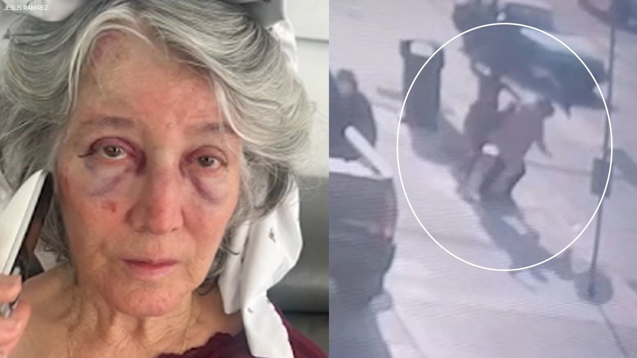 74 year old Woman Waiting At Long Beach Bus Stop Attacked Pushed Into 74-year-old-woman-waiting-at-long-beach-bus-stop-attacked-pushed-into