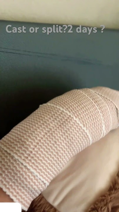 Cast Or Split Youtube