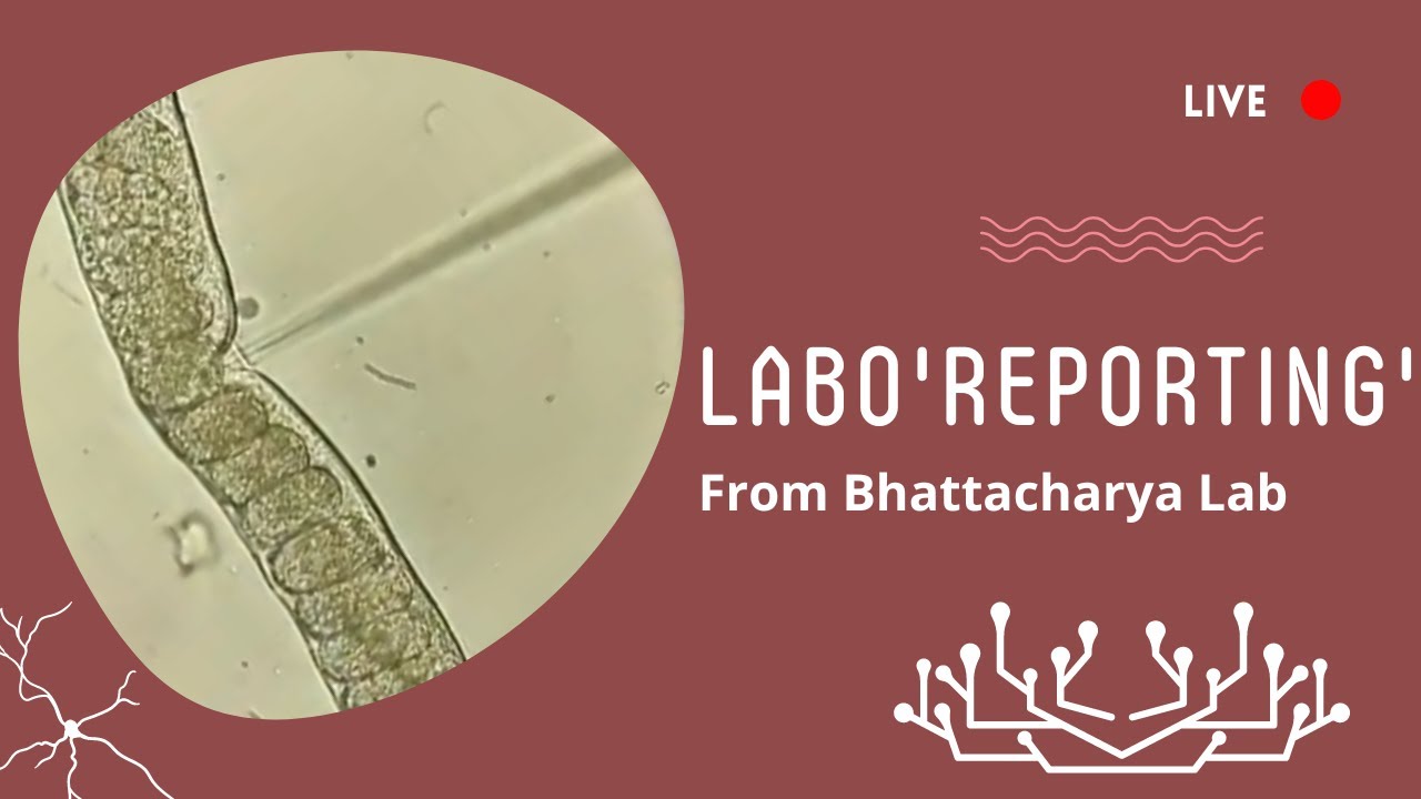 Labo'reporting' - Live from NCBS Lab: Brain Awareness Week Special ...