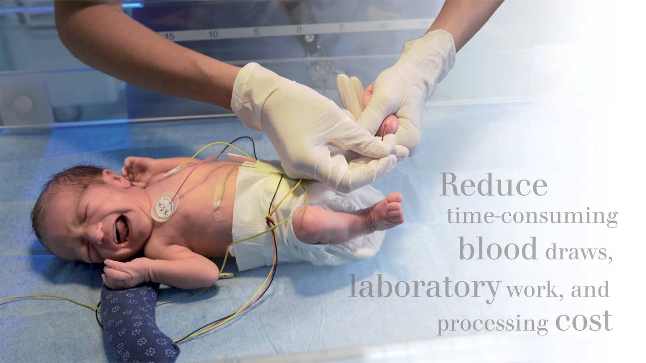 Dräger Jaundice Meter JM-105 - YouTube