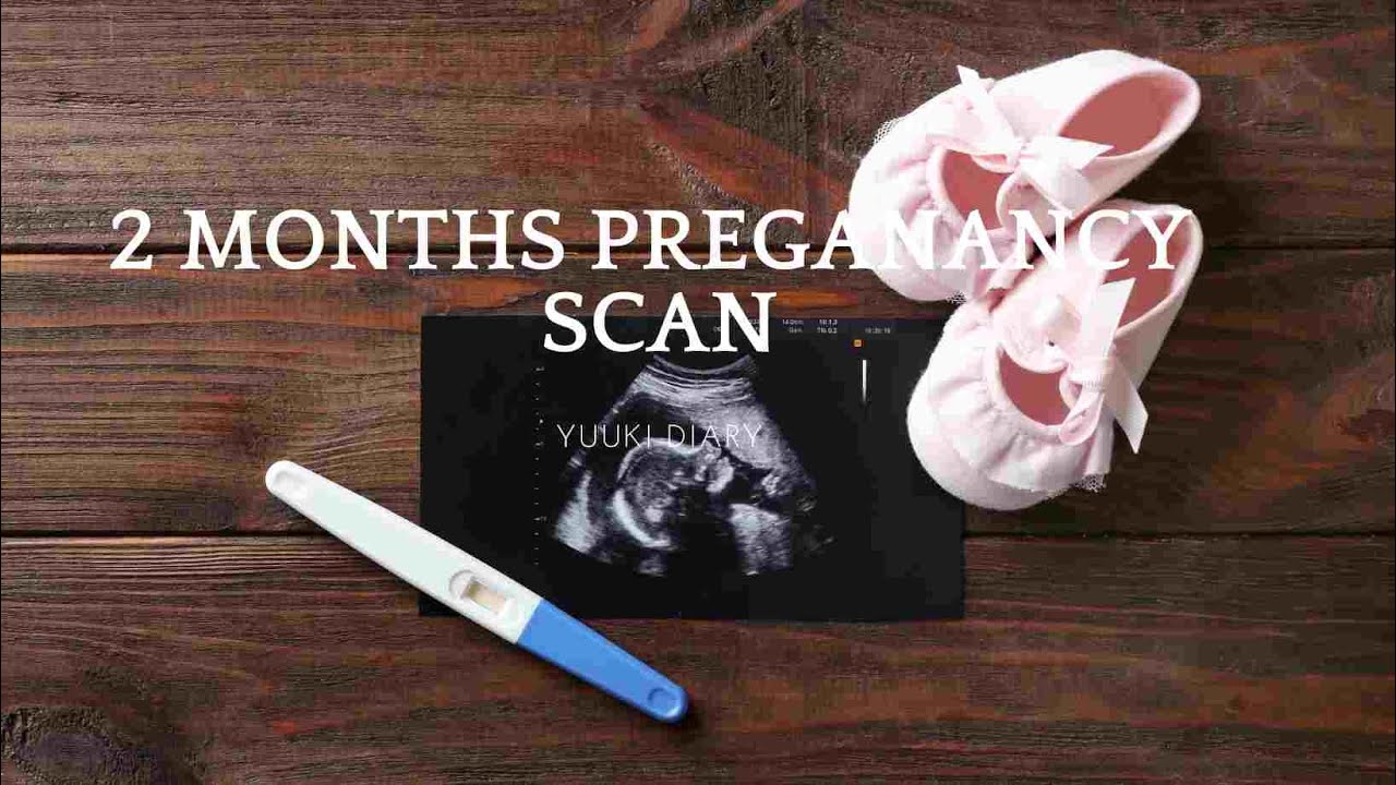 2 months ultrasound scan - YouTube