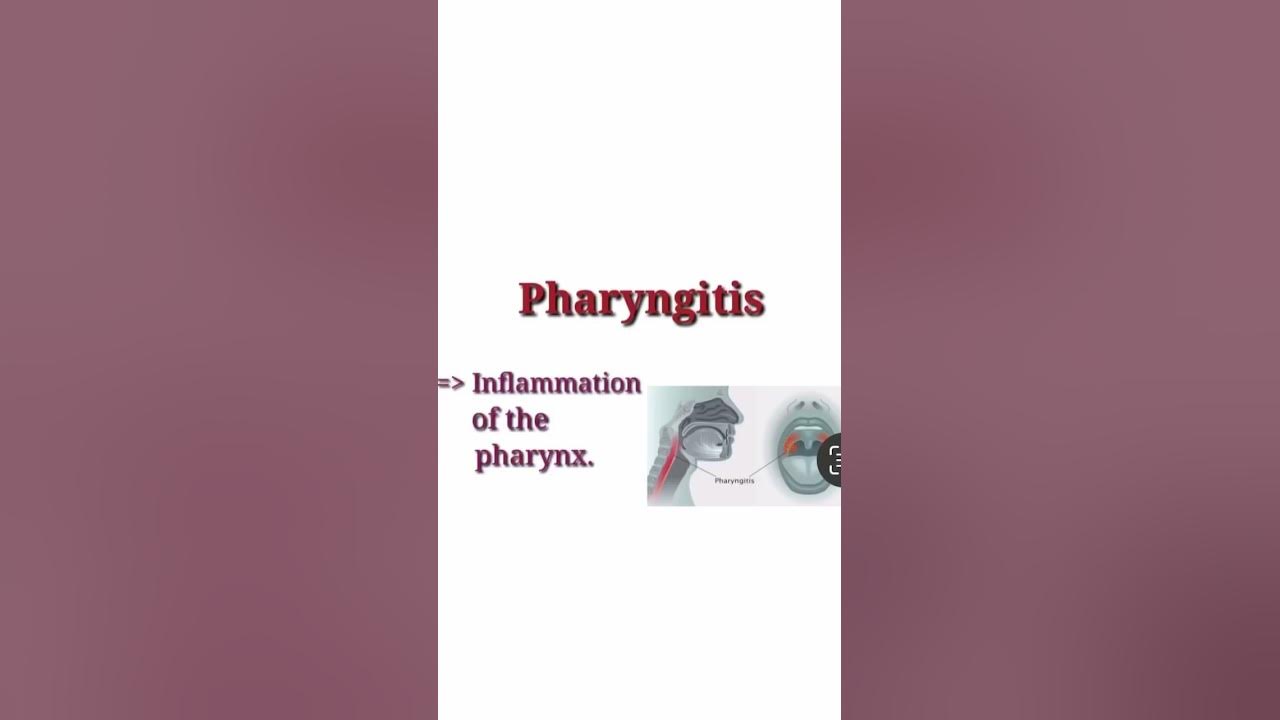 Pharyngitis Youtube