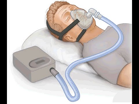 CPAP Therapy for Obstructive Sleep Apnea - YouTube