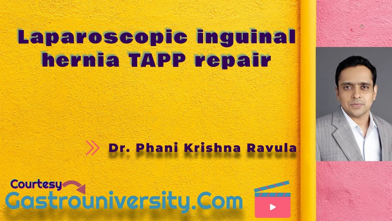Hernia-Laparoscopic inguinal hernia TAPP repair Unedited teaching Video ...