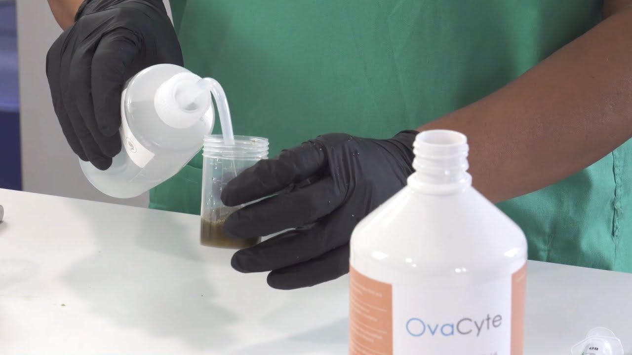 OvaCyte Faecal Analyser - Fluke Sample Preparation - YouTube