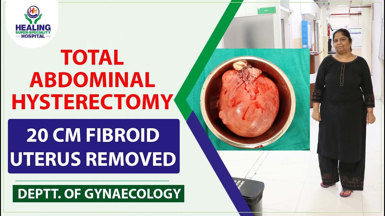 20 cm Fibroid Uterus Removed Surgically | Total Abdominal Hysterectomy ...