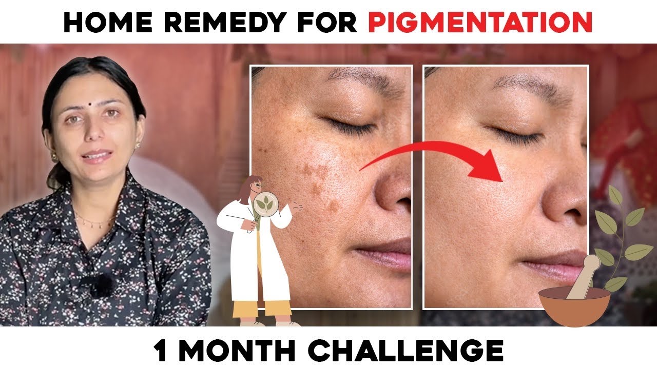 1-Month Challenge: Remove Pigmentation with the Best Home Remedy | Skin ...