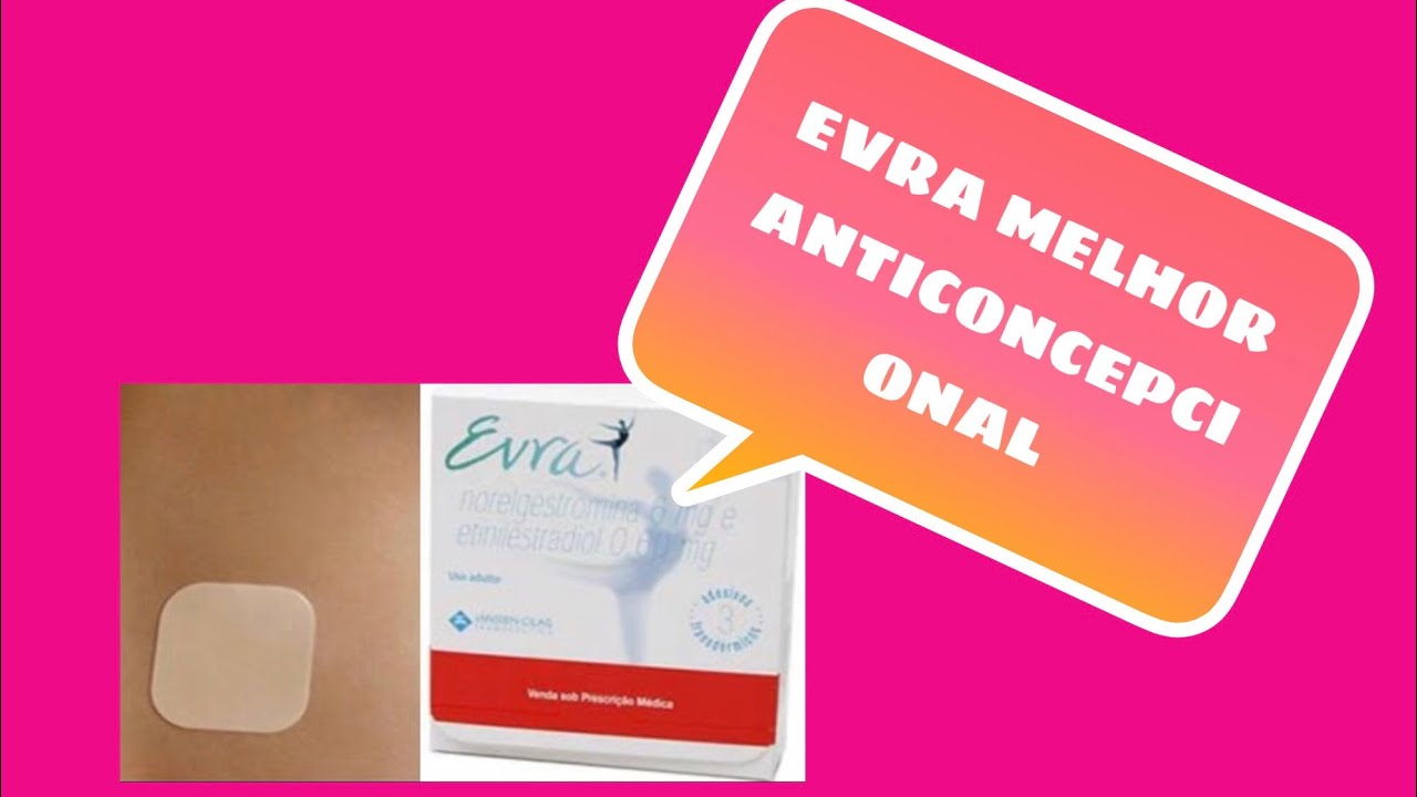 EVRA MELHOR ANTICONCEPCIONAL - YouTube
