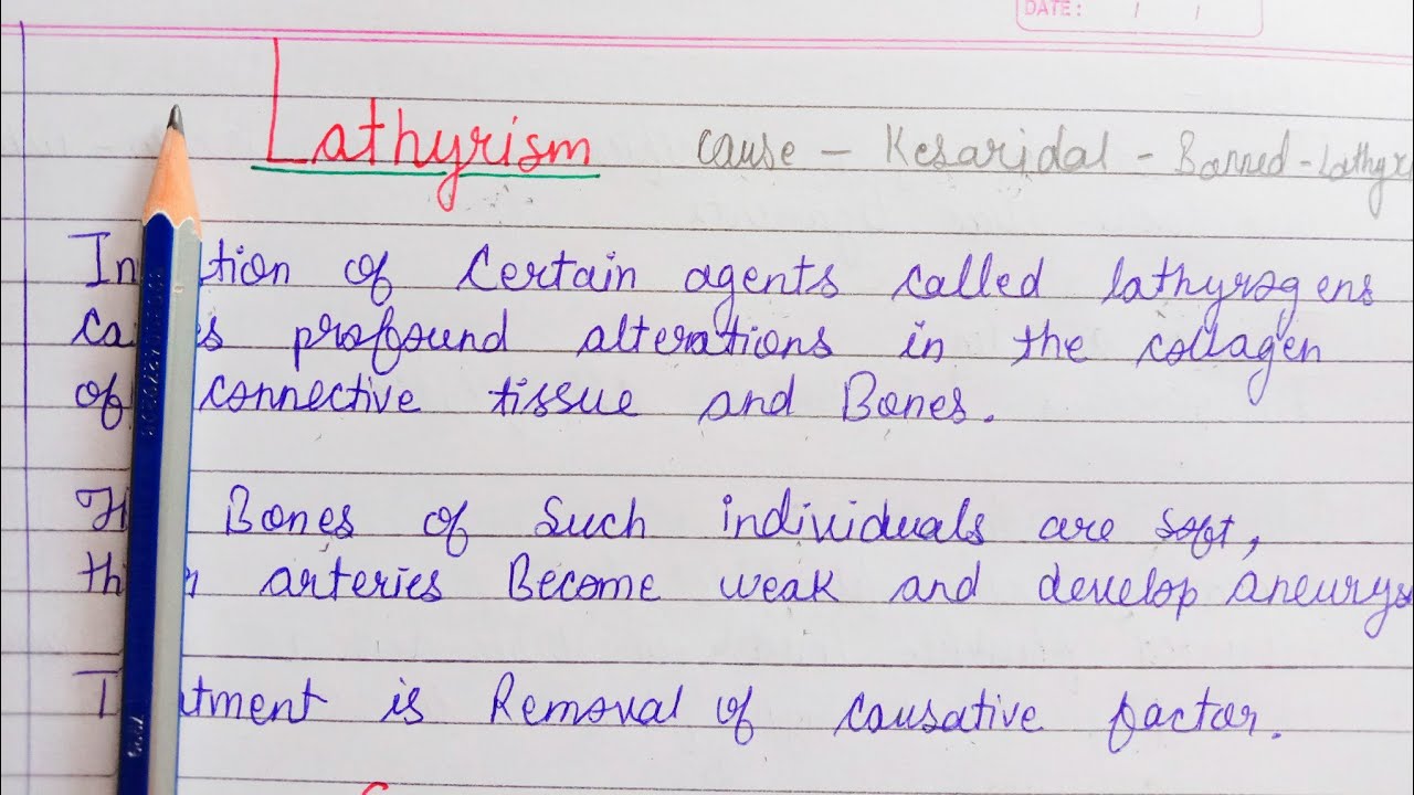Lathyrism (Metabolic bone disease) - YouTube