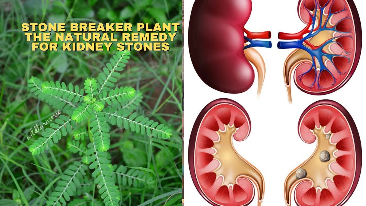 Stone Breaker Plant The Natural Remedy for Kidney Stones - YouTube