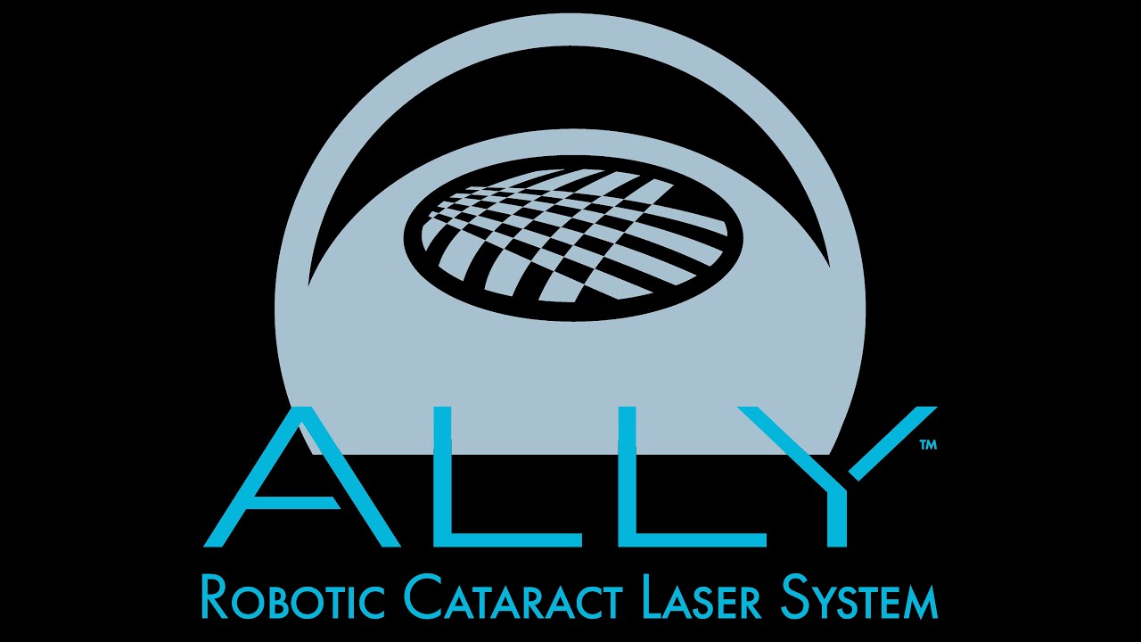 ALLY Laser Cataract System Patient Education Video - YouTube