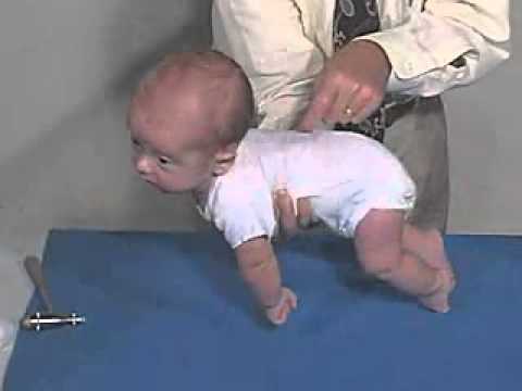 ANGLADE FISIOTERAPIA: TERAPIA E INTEGRACIÓN DE REFLEJOS PRIMITIVOS