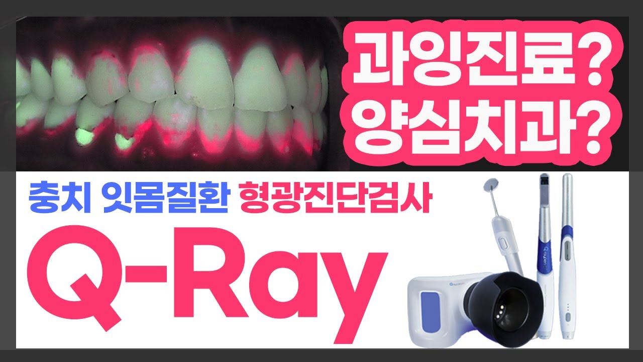 치과유목민을 위한 진단검사의 시각화&객관화, 큐레이(Q-ray)를 소개합니다 - YouTube