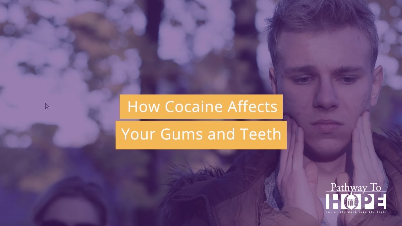 How Cocaine Affects Your Gums and Teeth | Facts About Drugs - YouTube