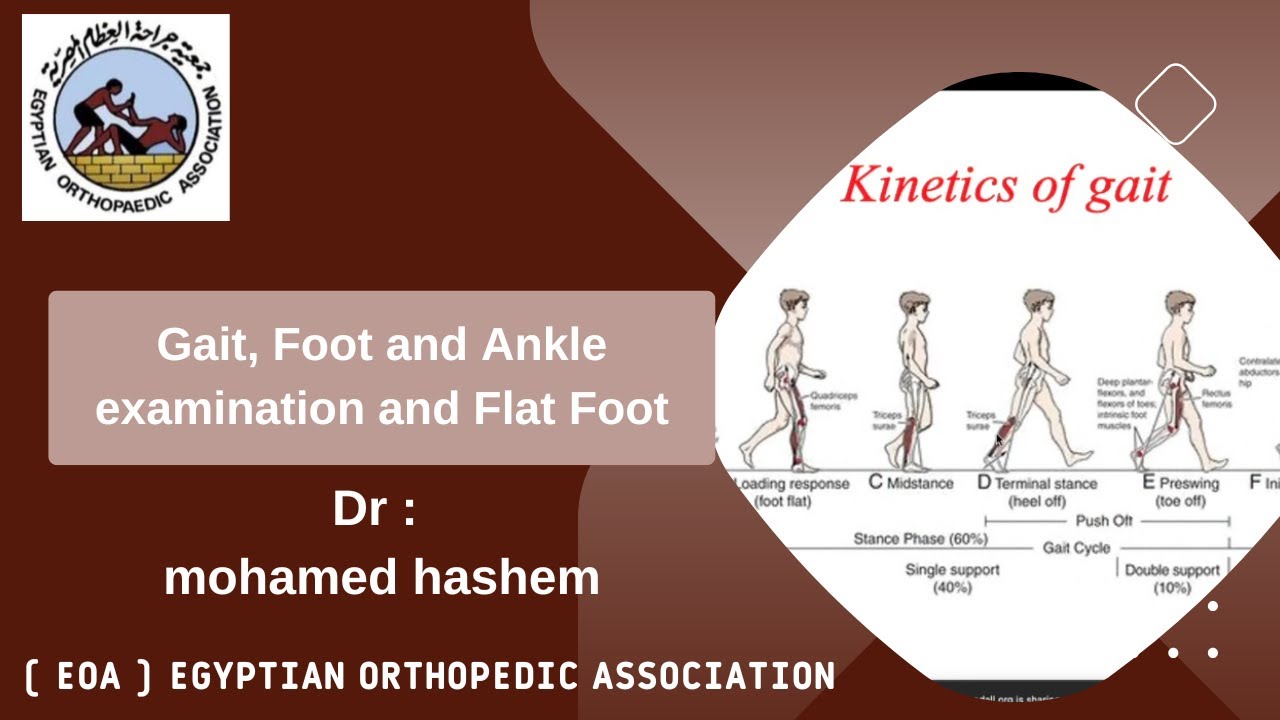 Gait , Foot and Ankle examination and Flat Foot ( Mr. Mohamed Hashem ...
