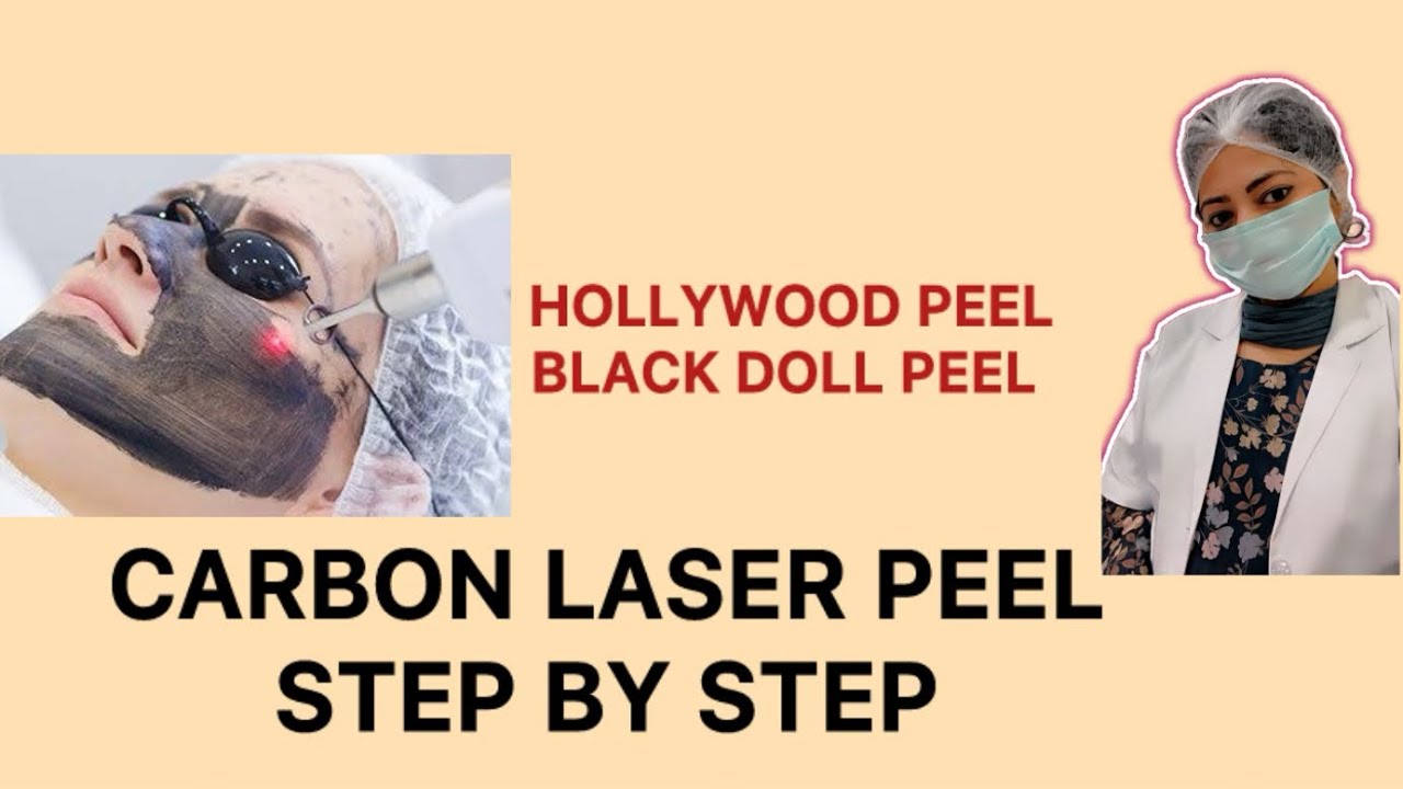 Carbon laser peel step by step full procedure - YouTube