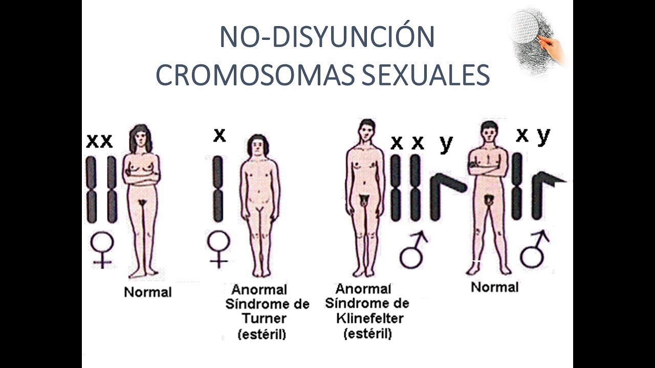 Cromosomas Sexuales Y S ndromes Relacionados X0 XXY XYY YouTube