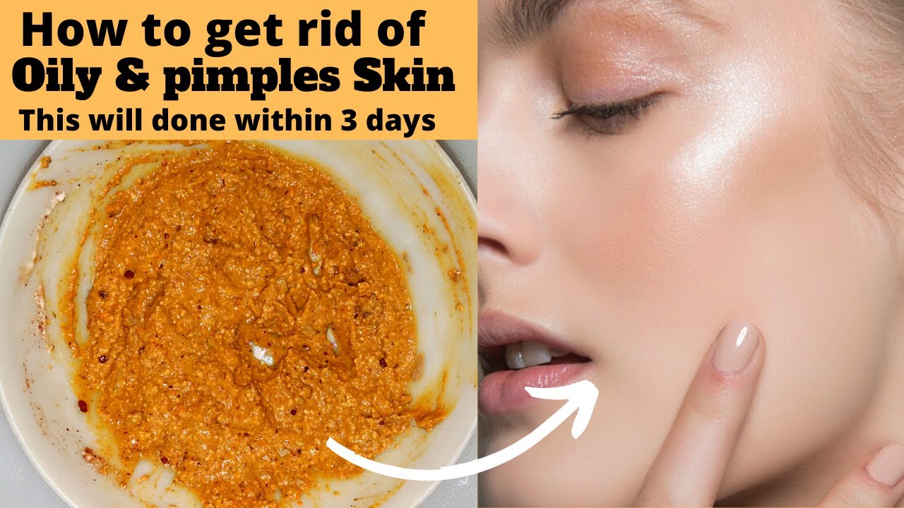 Simple Home Remedy for Oily Skin and Pimples | REMOVE OIL WITHIN 30 ...