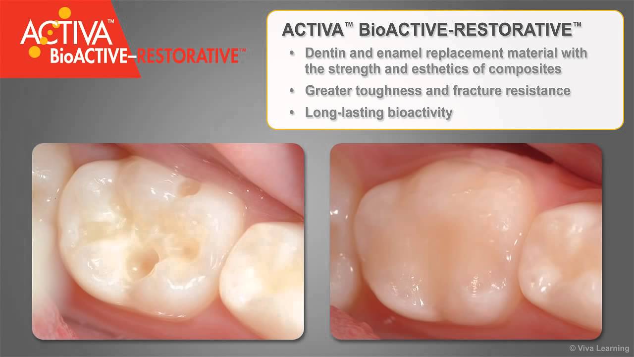 ACTIVA BioACTIVE D 720p - YouTube