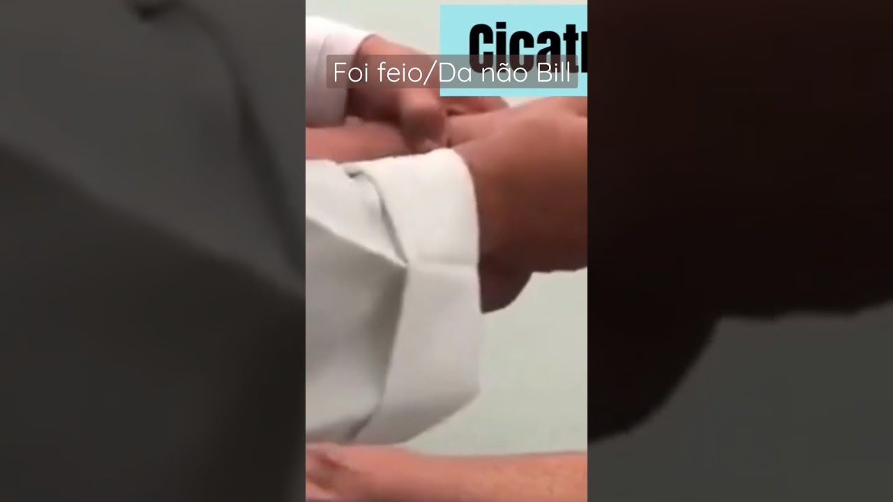 Cicatriz cirúrgica com aderências. - YouTube