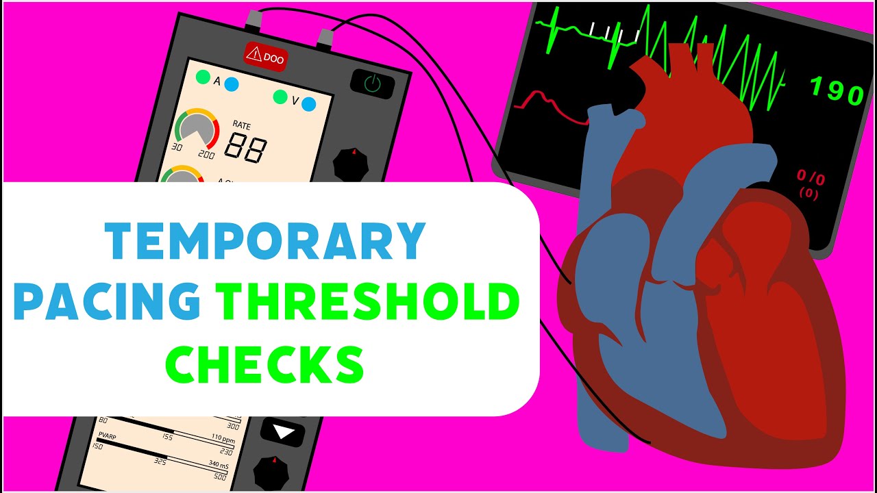 Temporary Pacing Threshold Checks - YouTube