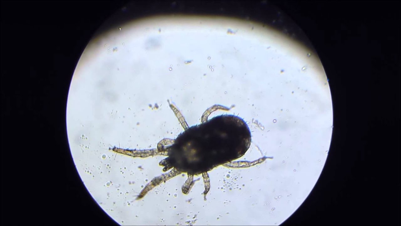 Rote Vogelmilbe - YouTube