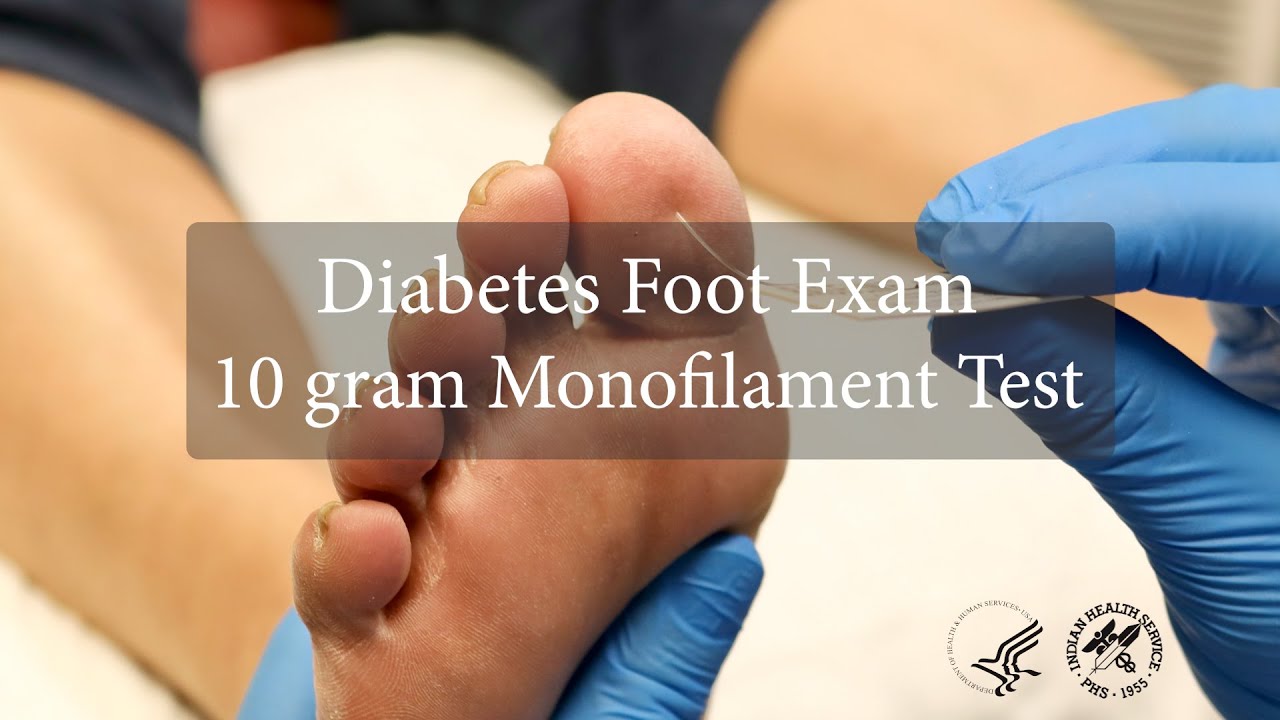 IHS Foot Care Monofilament Test - YouTube